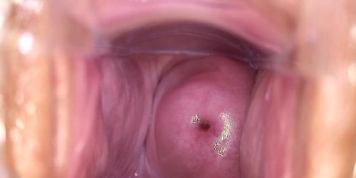 Hot Girl Using Speculum To Show Her Cervix