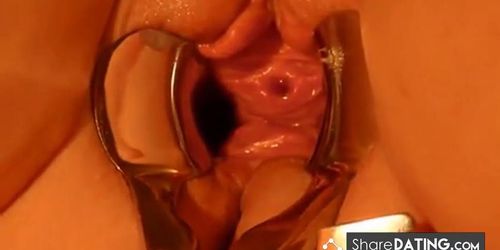 Free Catheter Porn Videos And Sex Movies Tnaflix