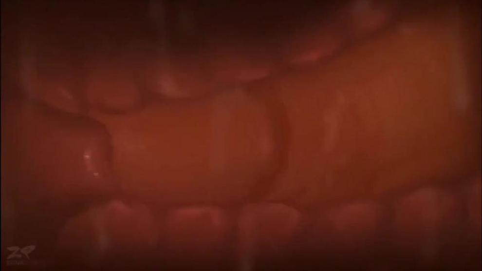 X Ray Porn Videos 9915