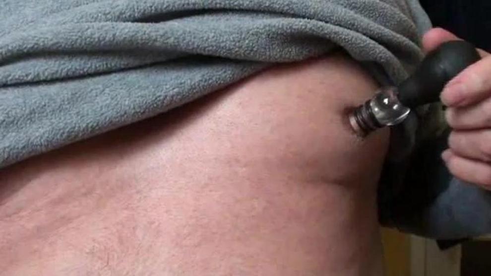 Nipple Pump Porn Videos