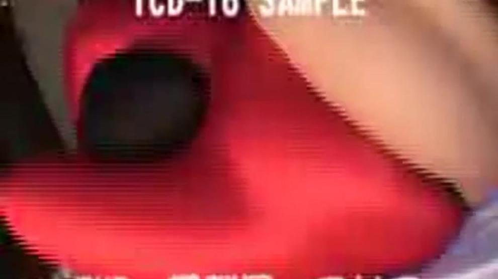 Icd 16 0859