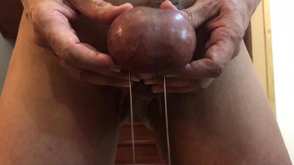 Needles In Balls