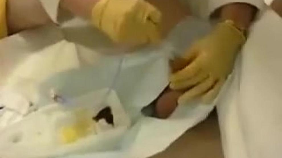 Injection Of Masculine Catheter Excruciating Porn Videos 4185