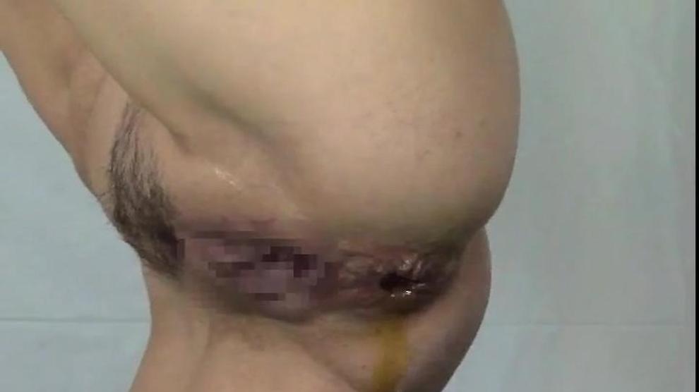 Elmers Wife Anal Fisting And Enema With One Leg Tied High Porn Videos