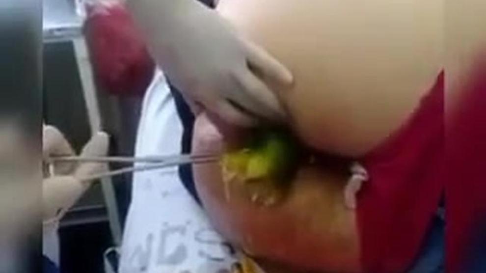 Cucumber Stuck In Asshole