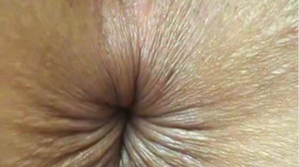 Close Up Butthole Winking Porn Videos